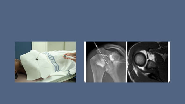 Radiographic procedure arthogram.....pptx