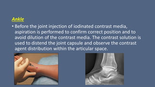 Radiographic procedure arthogram.....pptx
