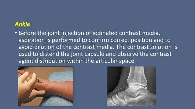 Radiographic procedure arthogram.....pptx