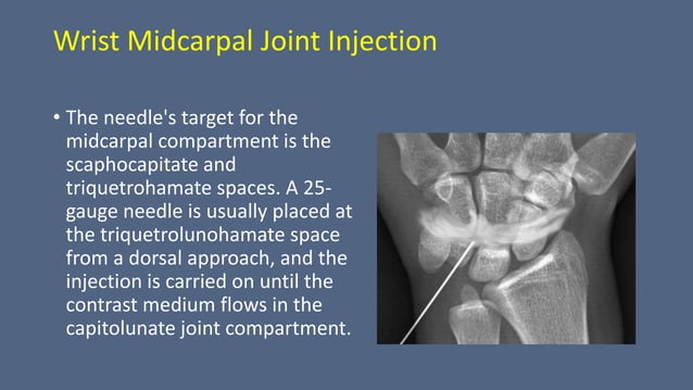 Radiographic procedure arthogram.....pptx
