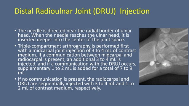 Radiographic procedure arthogram.....pptx