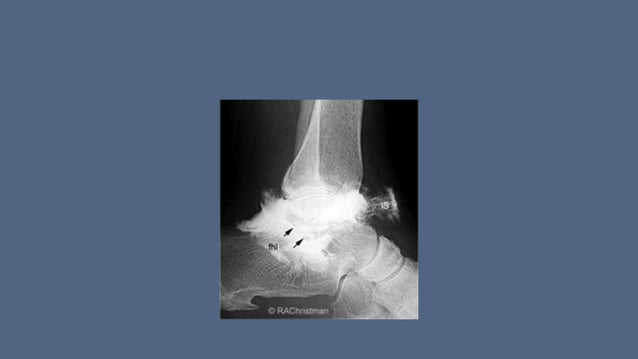 Radiographic procedure arthogram.....pptx