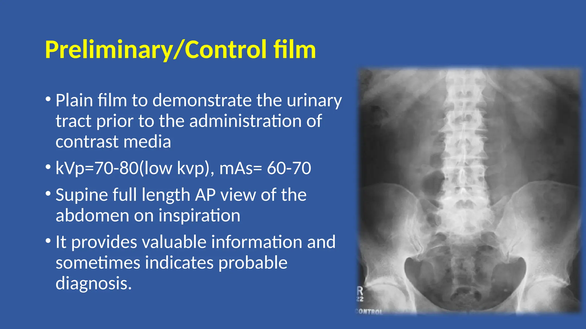 RADIOGRAPHIC PROCEDURE IVU.pptx......... | PPTX