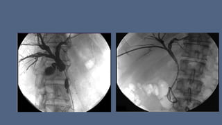 Radiographic procedure PTC & PTB..D.pptx