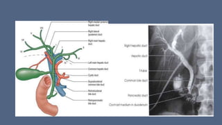 Radiographic procedure PTC & PTB..D.pptx