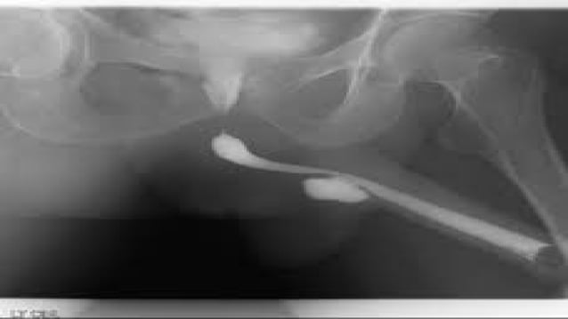 Radiographic Procedure (RGU & MCUG) - Saroj.pptx