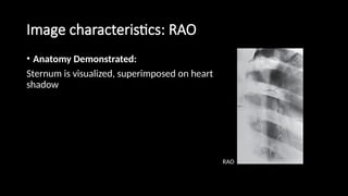 Radiographic Procedures for Bony thorax and Sternum.pptx