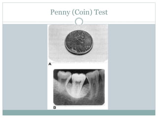RADIOGRAPHIC QUALITY ASSURANCE AND INFECTION CONTROL.pptx