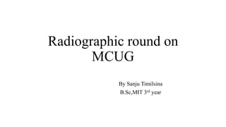 Radiographic round on mcug | PPTX