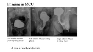 Radiographic round on mcug | PPT