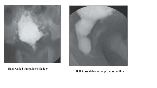 Radiographic round on mcug | PPTX