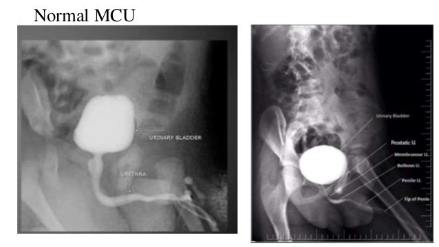 Radiographic round on mcug