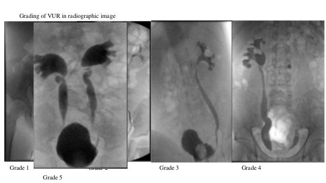 Radiographic round on mcug