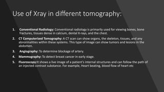 Radiographic system clinical engineering | PPTX