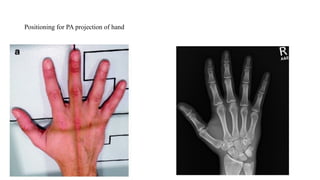 RADIOGRAPHIC TECHNIQUE USED IN X-RAYS.pptx