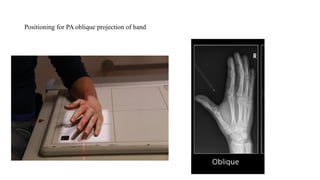 RADIOGRAPHIC TECHNIQUE USED IN X-RAYS.pptx