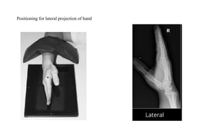 RADIOGRAPHIC TECHNIQUE USED IN X-RAYS.pptx