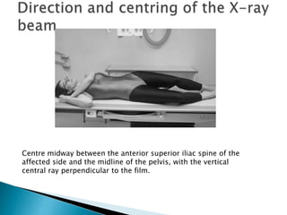 RADIOGRAPHIC TECHNIQUE 1 pelvic.pptx