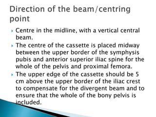 RADIOGRAPHIC TECHNIQUE 1 pelvic.pptx | Death, Injury, or Military ...