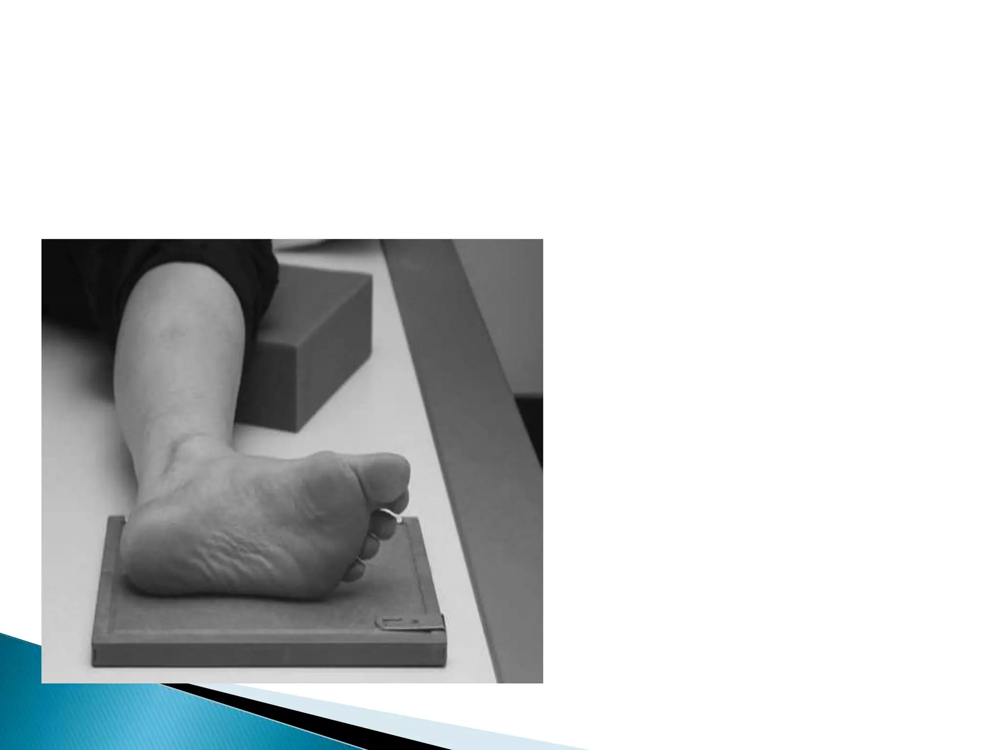 RADIOGRAPHIC TECHNIQUE FOOT.pptx