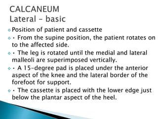 RADIOGRAPHIC TECHNIQUE FOOT.pptx