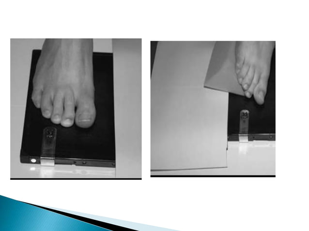 RADIOGRAPHIC TECHNIQUE FOOT.pptx
