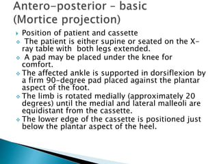 RADIOGRAPHIC TECHNIQUE FOOT.pptx