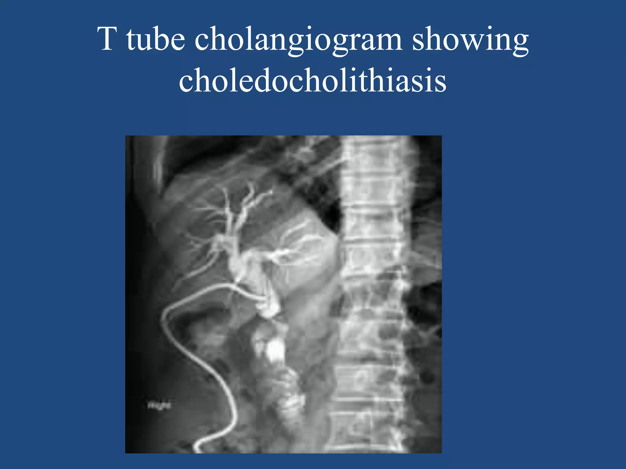 Radiographic technique of biliary system | PPTX
