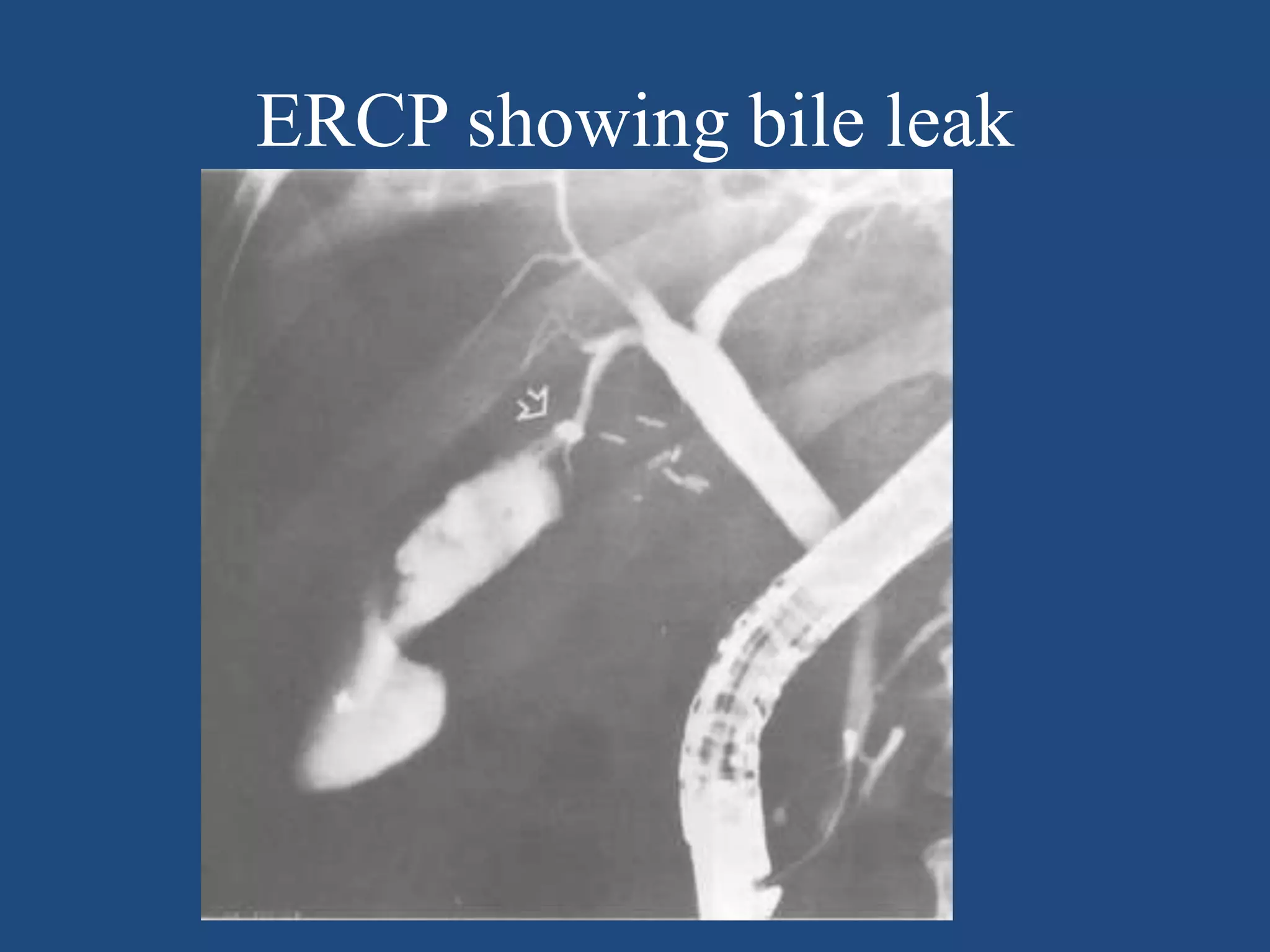 Radiographic technique of biliary system | PPTX