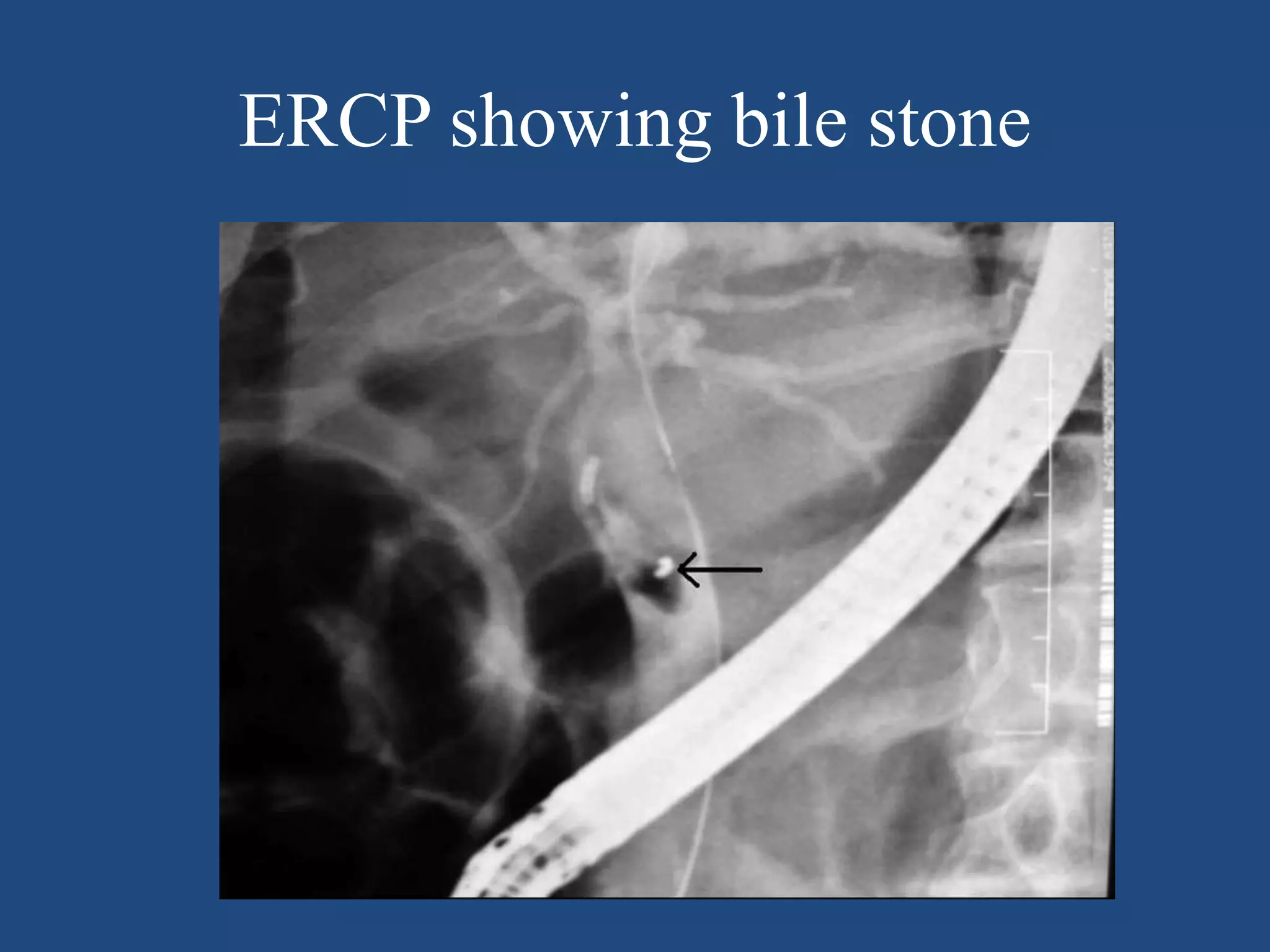 Radiographic technique of biliary system | PPTX
