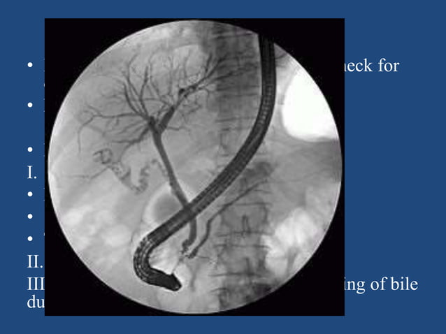 Radiographic technique of biliary system | PPTX | Digestive Disorders ...