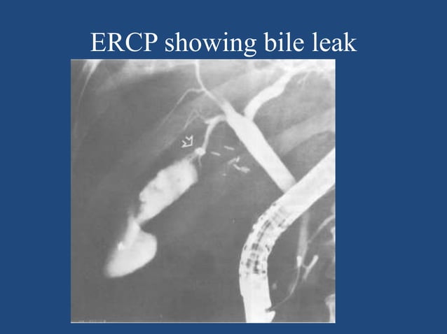 Radiographic technique of biliary system | PPTX | Digestive Disorders ...