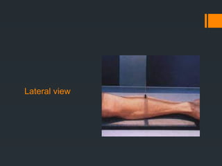 Radiographic technique of Leg, Knee, Femur V2.pptx