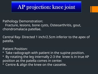 Radiographic technique of Leg, Knee, Femur V2.pptx