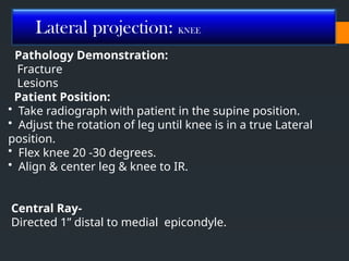 Radiographic technique of Leg, Knee, Femur V2.pptx