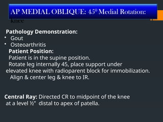 Radiographic technique of Leg, Knee, Femur V2.pptx
