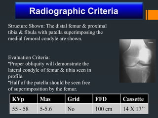 Radiographic technique of Leg, Knee, Femur V2.pptx