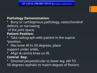 Radiographic technique of Leg, Knee, Femur V2.pptx