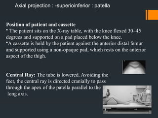 Radiographic technique of Leg, Knee, Femur V2.pptx