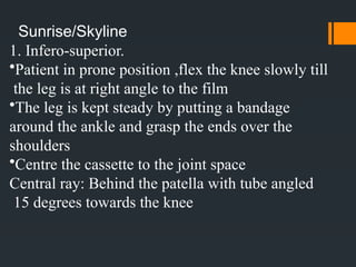 Radiographic technique of Leg, Knee, Femur V2.pptx