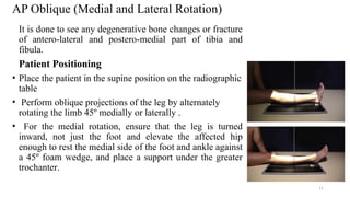 RADIOGRAPHIC TECHNIQUE OF LEG, KNEE JOINT AND FEMUR.pptx