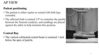 RADIOGRAPHIC TECHNIQUE OF LEG, KNEE JOINT AND FEMUR.pptx
