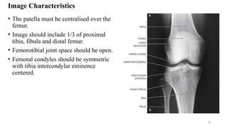 RADIOGRAPHIC TECHNIQUE OF LEG, KNEE JOINT AND FEMUR.pptx