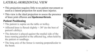 RADIOGRAPHIC TECHNIQUE OF LEG, KNEE JOINT AND FEMUR.pptx