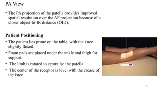 RADIOGRAPHIC TECHNIQUE OF LEG, KNEE JOINT AND FEMUR.pptx
