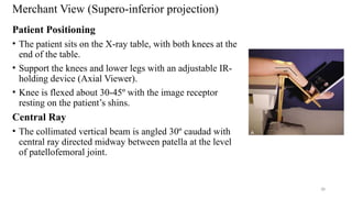 RADIOGRAPHIC TECHNIQUE OF LEG, KNEE JOINT AND FEMUR.pptx
