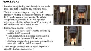 RADIOGRAPHIC TECHNIQUE OF LEG, KNEE JOINT AND FEMUR.pptx