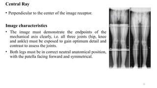 RADIOGRAPHIC TECHNIQUE OF LEG, KNEE JOINT AND FEMUR.pptx