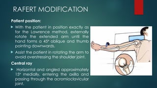 RADIOGRAPHIC TECHNIQUE OF SHOULDER(1).pptx