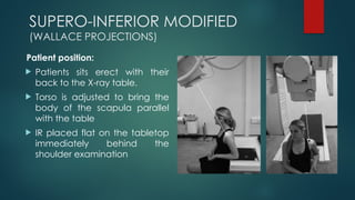 RADIOGRAPHIC TECHNIQUE OF SHOULDER(1).pptx
